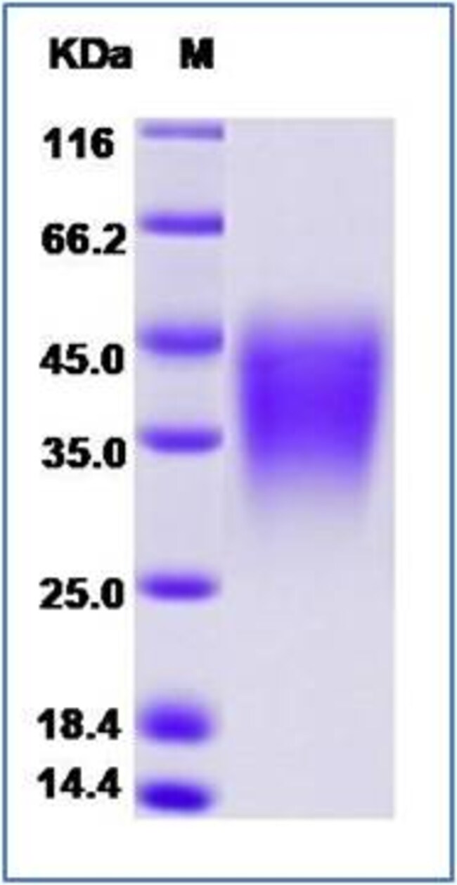 Sino Biological VISTA Protein, Human, Recombinant (His Tag), HPLC ...