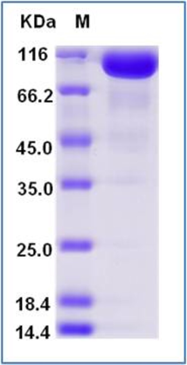 Sino Biological PSMA Protein, Human, Recombinant (His Tag), HPLC ...