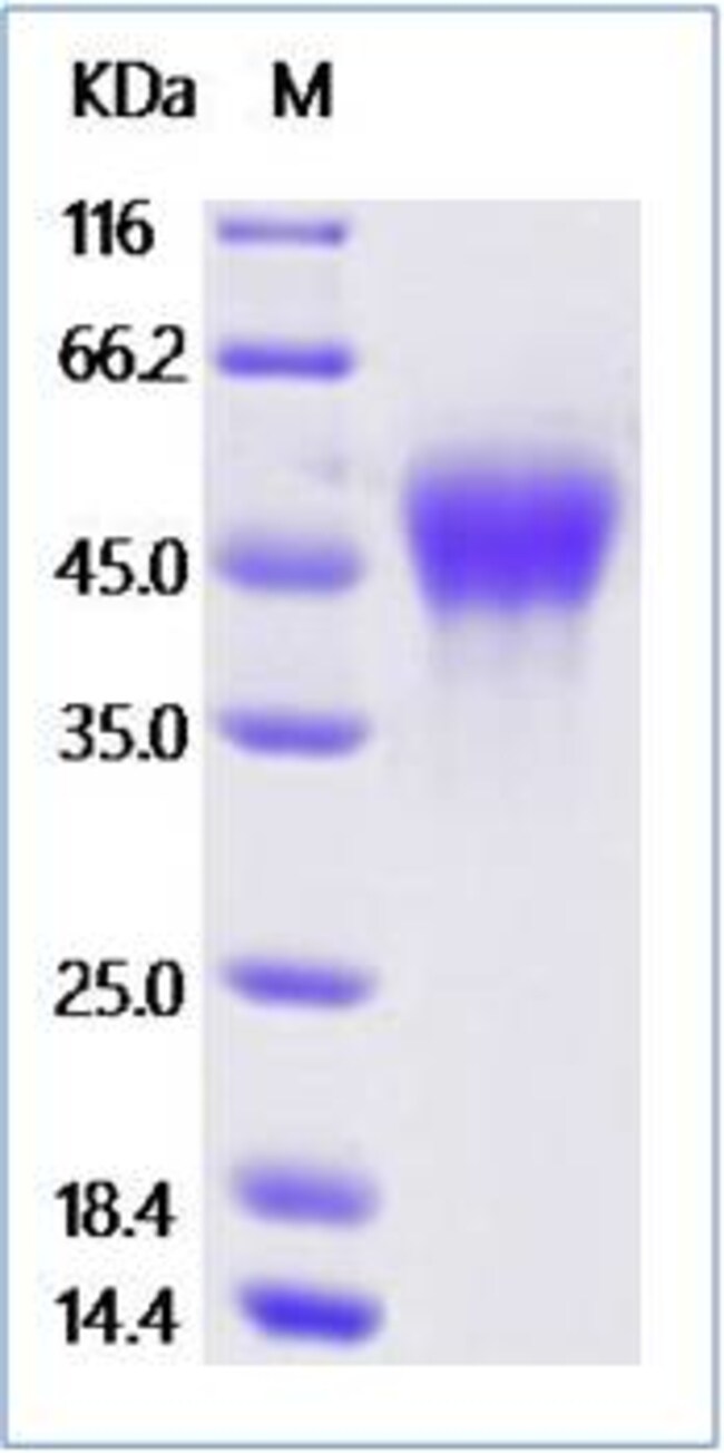 Sino Biological JAML Protein, Mouse, Recombinant (ECD, His Tag) 50µg ...