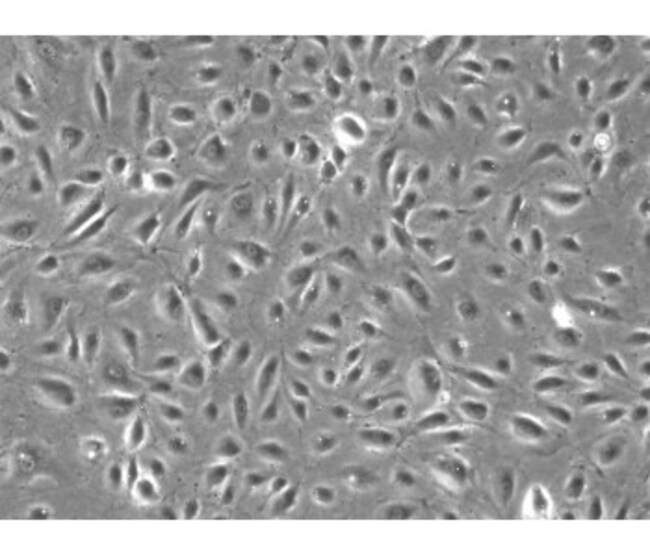iXCells Biotechnologies Human Brain Microvascular Endothelial Cells ...