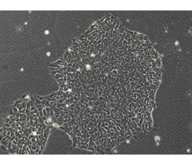 iXCells Biotechnologies Human iPS Cell Line (Type 2 Diabetes), Quantity ...