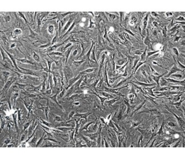 iXCells Biotechnologies iMEF Feeders, Quantity: Each of 1 | Fisher ...