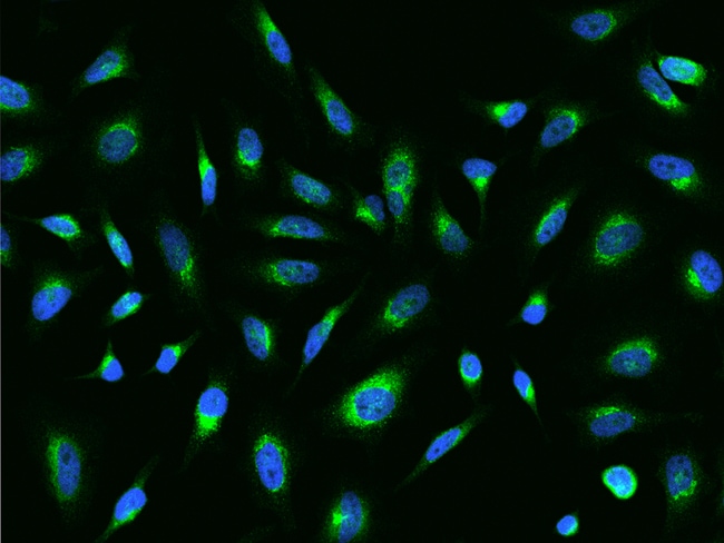 Sino Biological Inhibin beta A / Activin A Antibody, Rabbit PAb ...