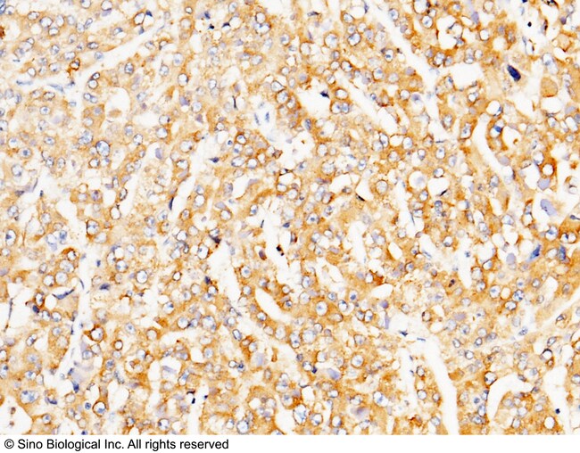 Sino Biological LRPAP1 / A2MRAP Antibody, Rabbit PAb, Antigen Affinity ...