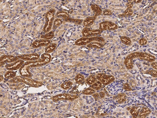 Sino Biological Granulin / GRN / Progranulin Antibody, Rabbit PAb ...