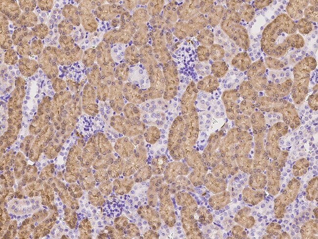 Sino Biological Transferrin Receptor / TFRC Antibody, Rabbit MAb 100µL ...