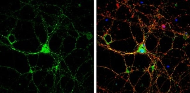 Abcam Anti-SARM antibody 100ul, Quantity: Each of 1 | Fisher Scientific