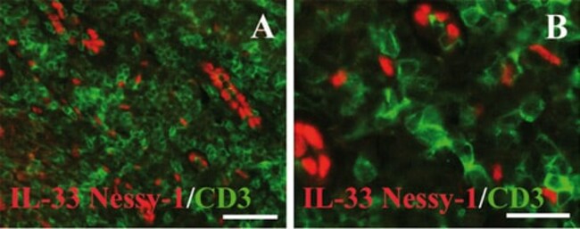 Abcam Anti-CD3 antibody [SP7] 100ul, Quantity: Each of 1 | Fisher ...