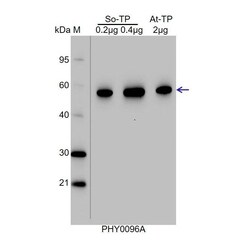 PHYTO AB INC RbcL Antibody Immunogen: ATCG00490 RuBisCO is an enzyme ...