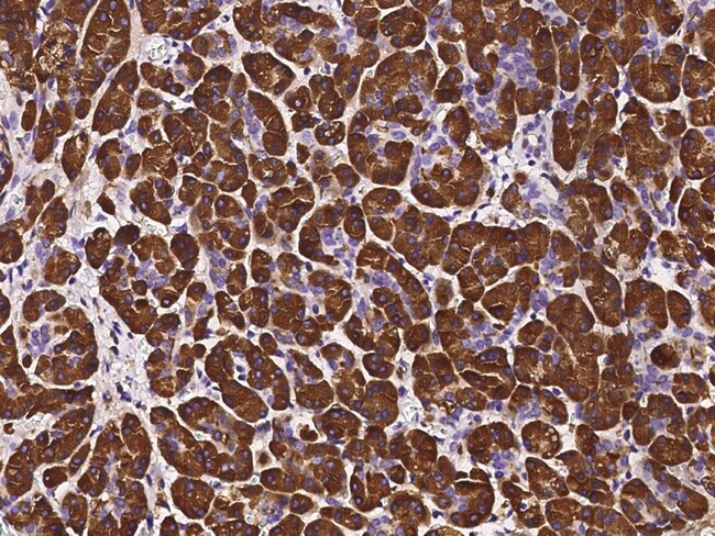 Sino Biological PNLIP Antibody, Rabbit MAb 100µL, Quantity: Each of 1 ...