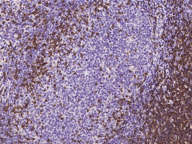 Sino Biological CD3 epsilon / CD3e Antibody, Mouse MAb 50uL, Quantity ...