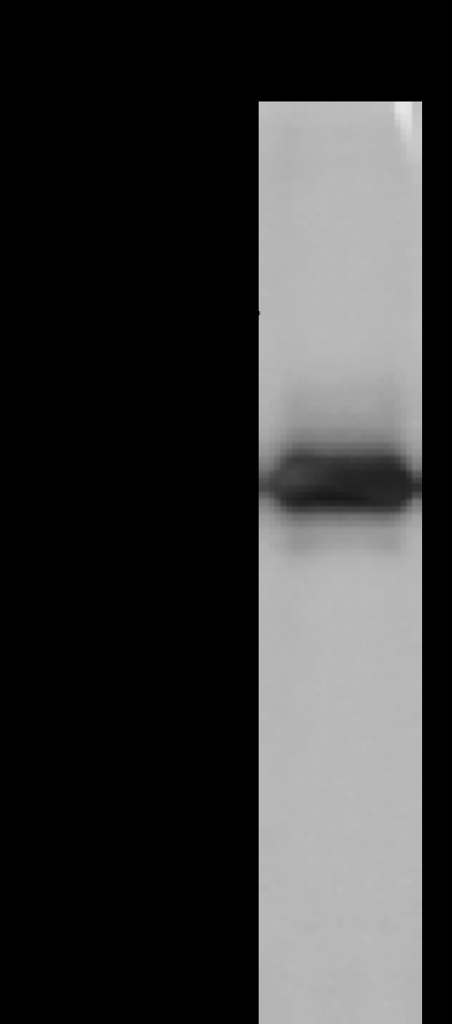 Sino Biological Human respiratory syncytial virus (RSV) (strain A2 ...