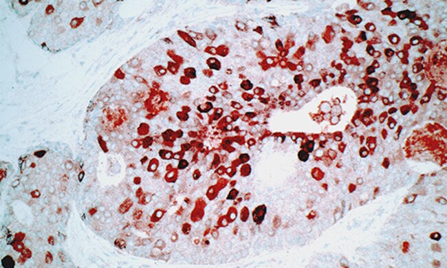 Biogenex Laboratories Estrogen : PS2.1 : 6mL, Quantity: Each of 1 ...