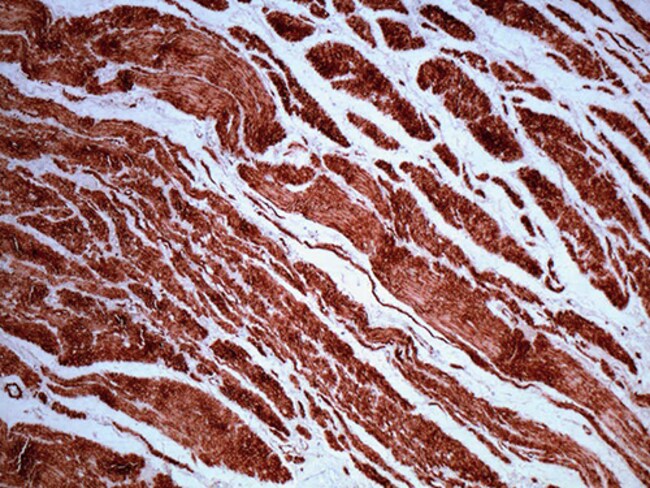 Biogenex Laboratories Actin : 1A4 : 1mL, Quantity: Each of 1 | Fisher ...