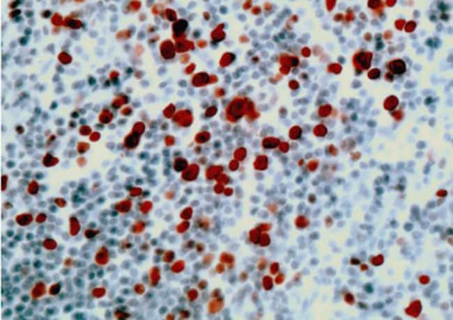 Biogenex Laboratories KI-67 : MIB-1 : 1mL | Fisher Scientific