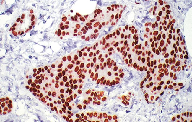 Biogenex Laboratories ER (Insite): ER88 : 1mL, Quantity: Each of 1 ...