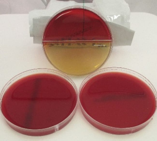 Oxyrase Oxypras 3-Pack: Bbe/Kvl Bi-Plate, Brucella, Pea 10/Pk, Quantity ...