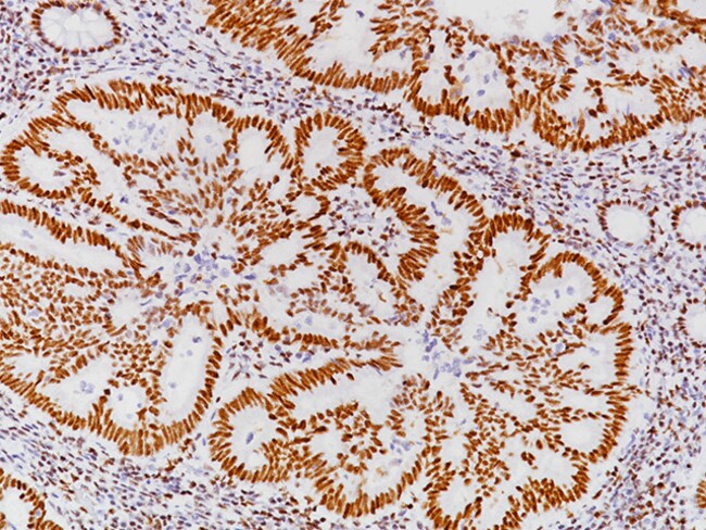 Biocare Medical, LLC PMS2, Post Meiotic Segregation Increased 2 Gene, 6 ...