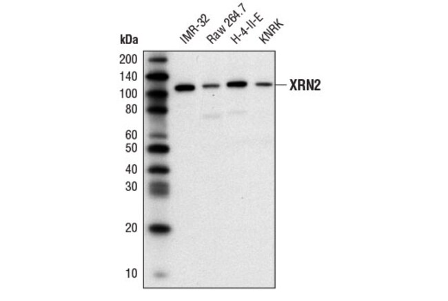 Cell Signaling Technology XRN2 (D6L5F) Rabbit mAb 100 µl, Quantity ...