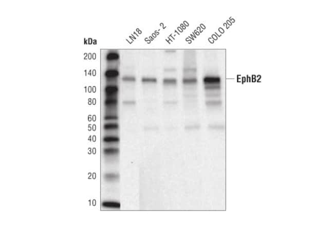 Cell Signaling Technology EphB2 (D2X2I) Rabbit mAb 100 µl, Quantity ...