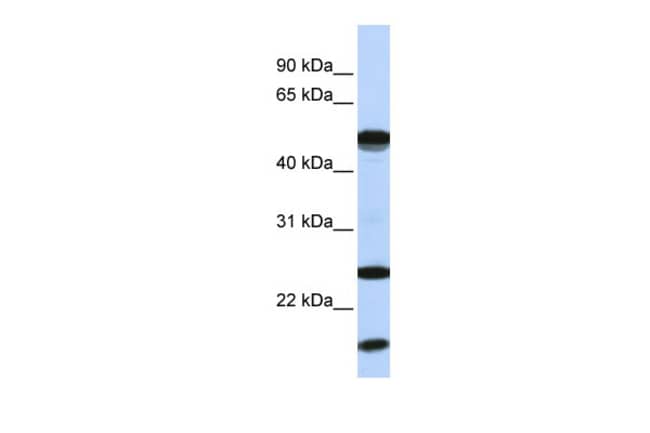 Aviva Systems Biology Corp UBE2L6 ANTIBODY 50UG/50UL | Fisher Scientific