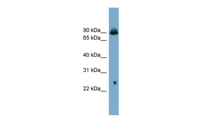 Aviva Systems Biology Corp SLC6A5 Antibody - middle region (ARP43873 ...