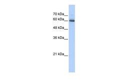 Aviva Systems Biology Corp SEMA4F Antibody - N-terminal region ...