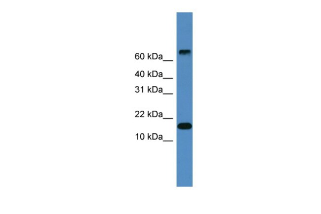 Aviva Systems Biology Corp CST9 ANTIBODY 50UG/50UL | Fisher Scientific