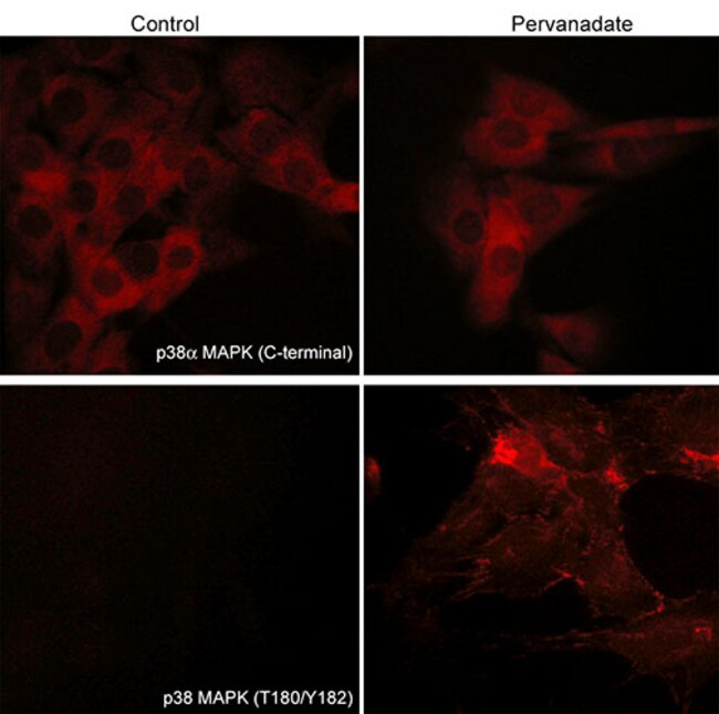 ECM Bioscience p38 MAPK Phospho-Regulation Antibody Sampler Kit, ECM Biosciences, | Fisher ...