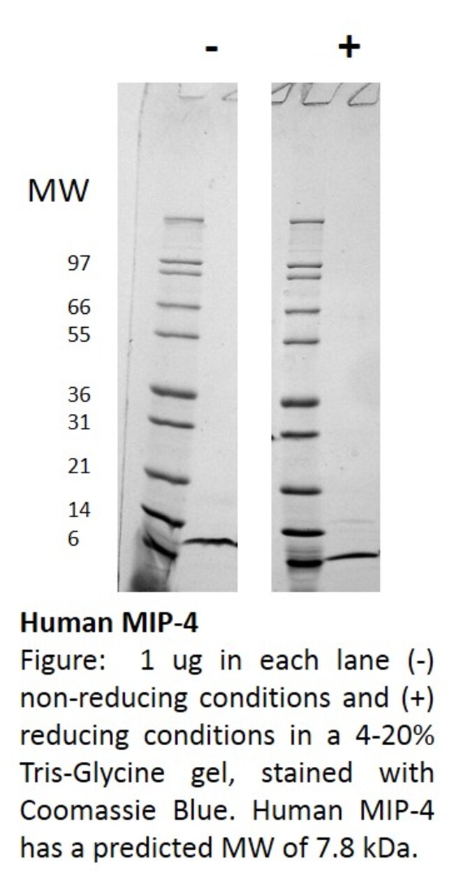 FUJIFILM IRVINE SCIENTIFIC INC Human MIP-4 (CCL18), Recombinant Protein, | Fisher Scientific