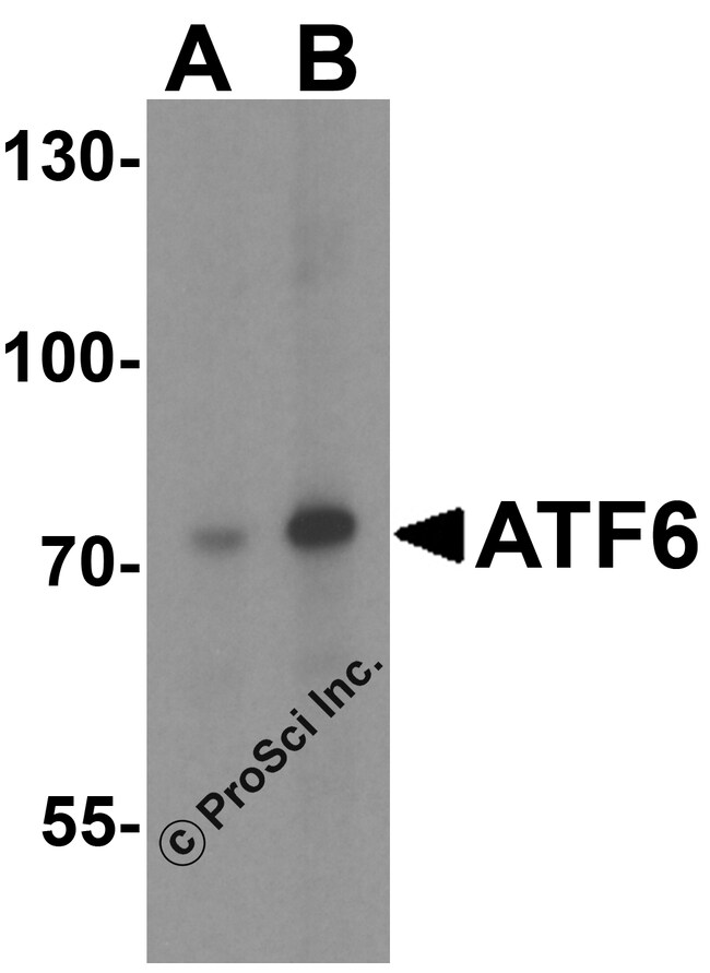 Prosci Incorp ATF6 Antibody, Rabbit Polyclonal, Quantity: Each of 1 ...