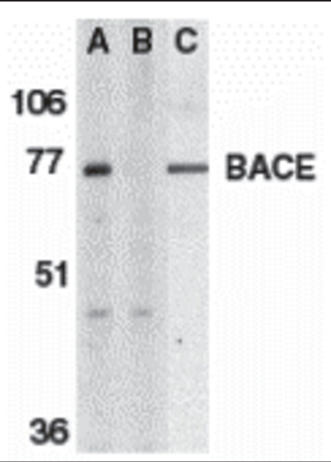 Prosci Incorp BACE Antibody, Rabbit Polyclonal, Quantity: Each of 1 | Fisher Scientific