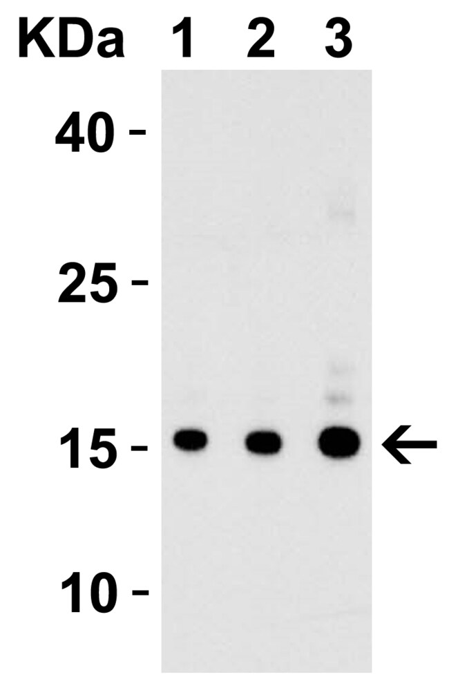 Prosci Incorp IL-17 Antibody, Rabbit Polyclonal, Quantity: Each of 1 | Fisher Scientific