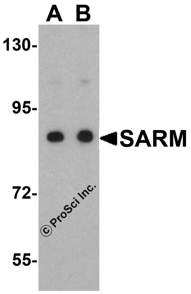 Prosci Incorp SARM Antibody, Rabbit Polyclonal | Fisher Scientific