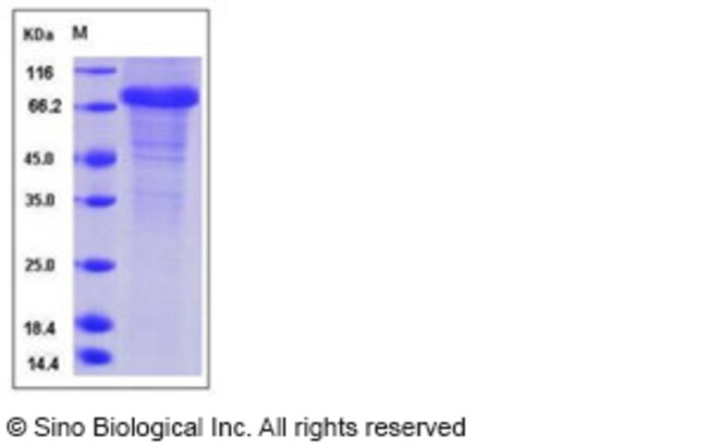 Sino Biological Human Follistatin / FST Protein (Fc Tag) | Fisher ...
