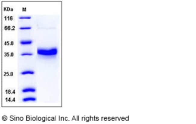 Sino Biological Human FOLR1 / Folate receptor alpha Protein (ECD,His ...