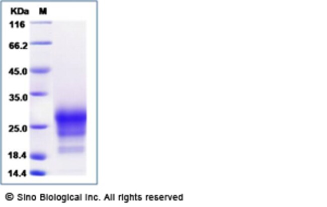 Sino Biological Human THY1 / CD90 Protein (His Tag) 50ug, Quantity ...