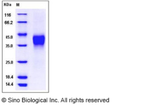 Sino Biological Mouse CD32 / FCGR2B Protein (His & AVI Tag ...