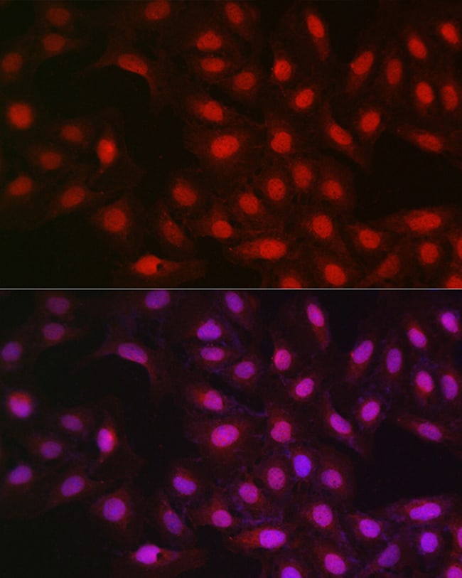 ABclonal Technology PPARG Polyclonal Antibody, 100UL, Validated in:WB ...