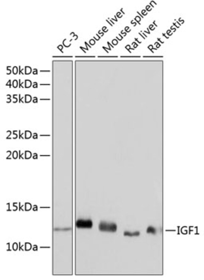 ABclonal Technology IGF1 Rabbit mAb 100 L, Quantity: Each of 1 | Fisher ...