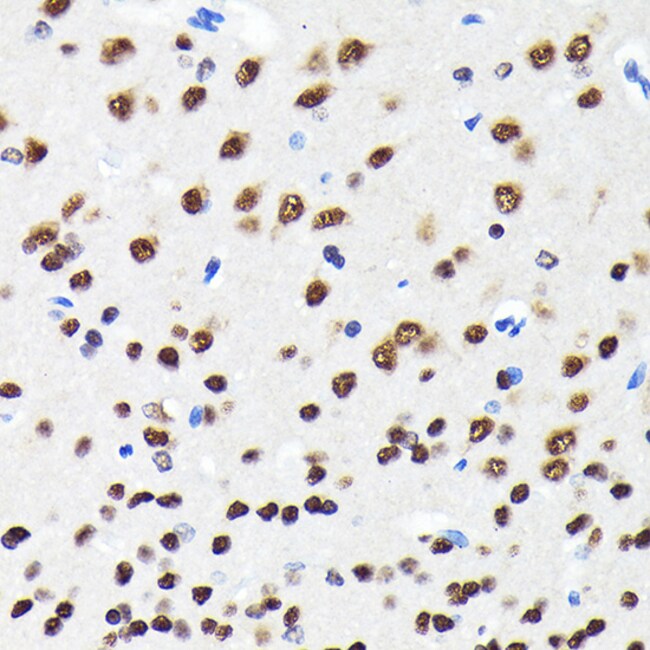 ABclonal Technology AKT1 Rabbit mAb 100 L, Quantity: Each of 1 | Fisher ...