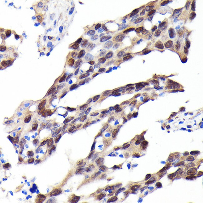 ABclonal Technology AKT1 Rabbit mAb 100 L, Quantity: Each of 1 | Fisher ...