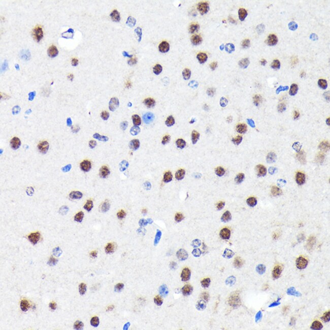 ABclonal Technology AKT1 Rabbit mAb 100 L, Quantity: Each of 1 | Fisher ...