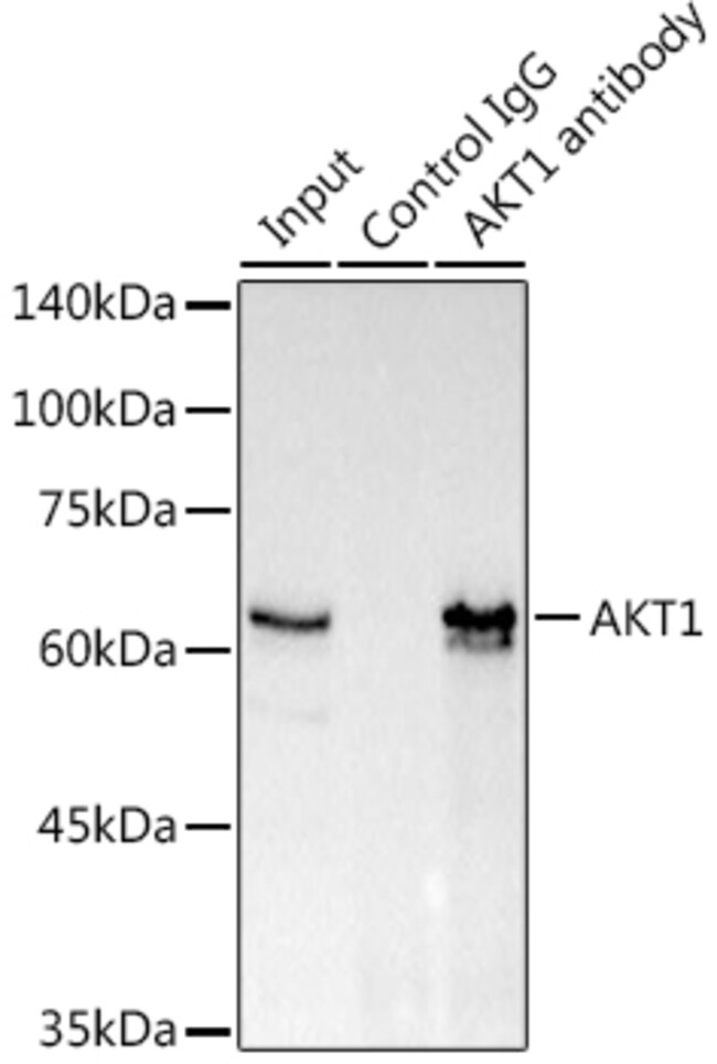 ABclonal Technology AKT1 Rabbit mAb 100 L, Quantity: Each of 1 | Fisher ...