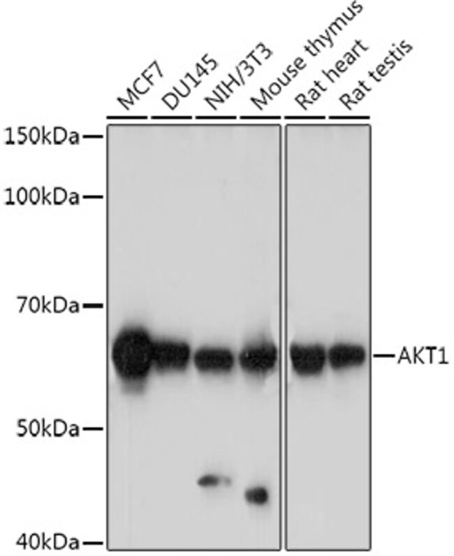 ABclonal Technology AKT1 Rabbit mAb 100 L, Quantity: Each of 1 | Fisher ...