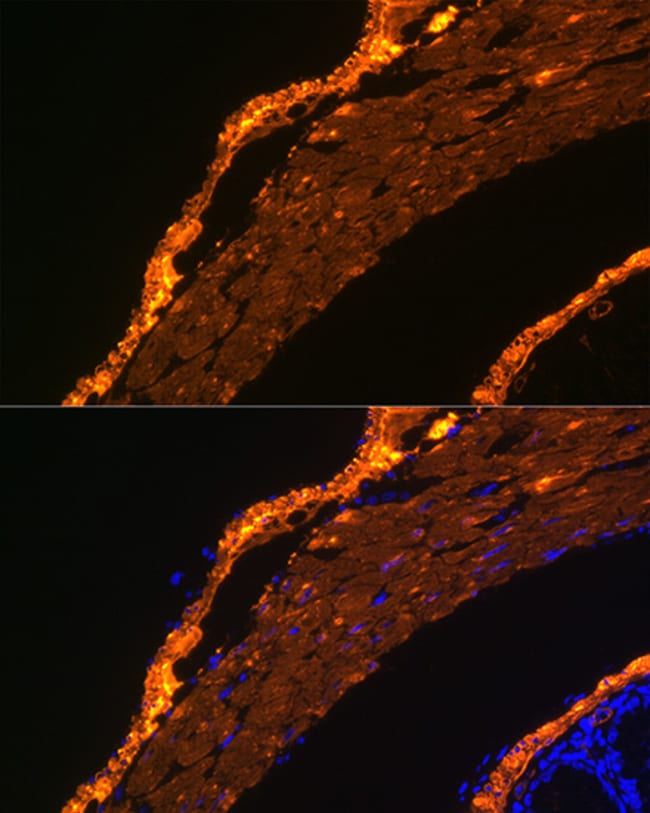 ABclonal Technology -Smooth Muscle Actin (ACTA2) Rabbit mAb 100 L ...