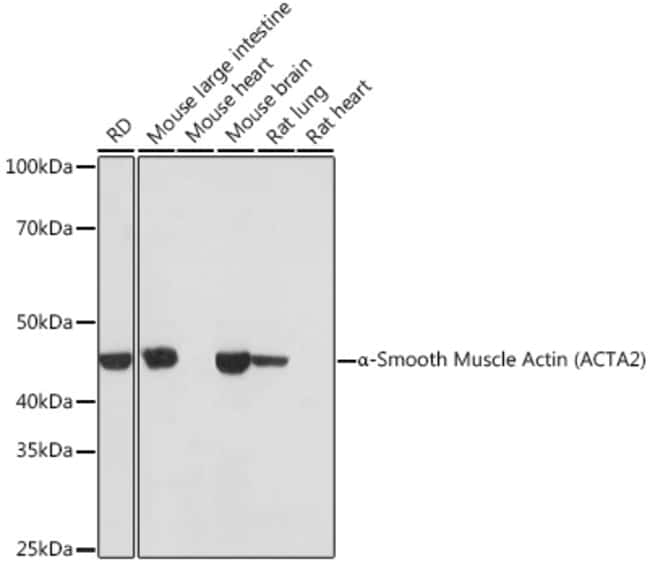 ABclonal Technology -Smooth Muscle Actin (ACTA2) Rabbit mAb 100 L ...