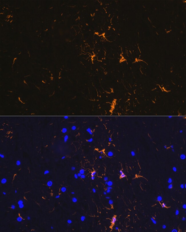 ABclonal Technology GFAP Rabbit mAb 100 L, Quantity: Each of 1 | Fisher ...