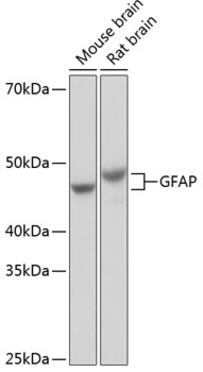 ABclonal Technology GFAP Rabbit mAb 100 L, Quantity: Each of 1 | Fisher ...