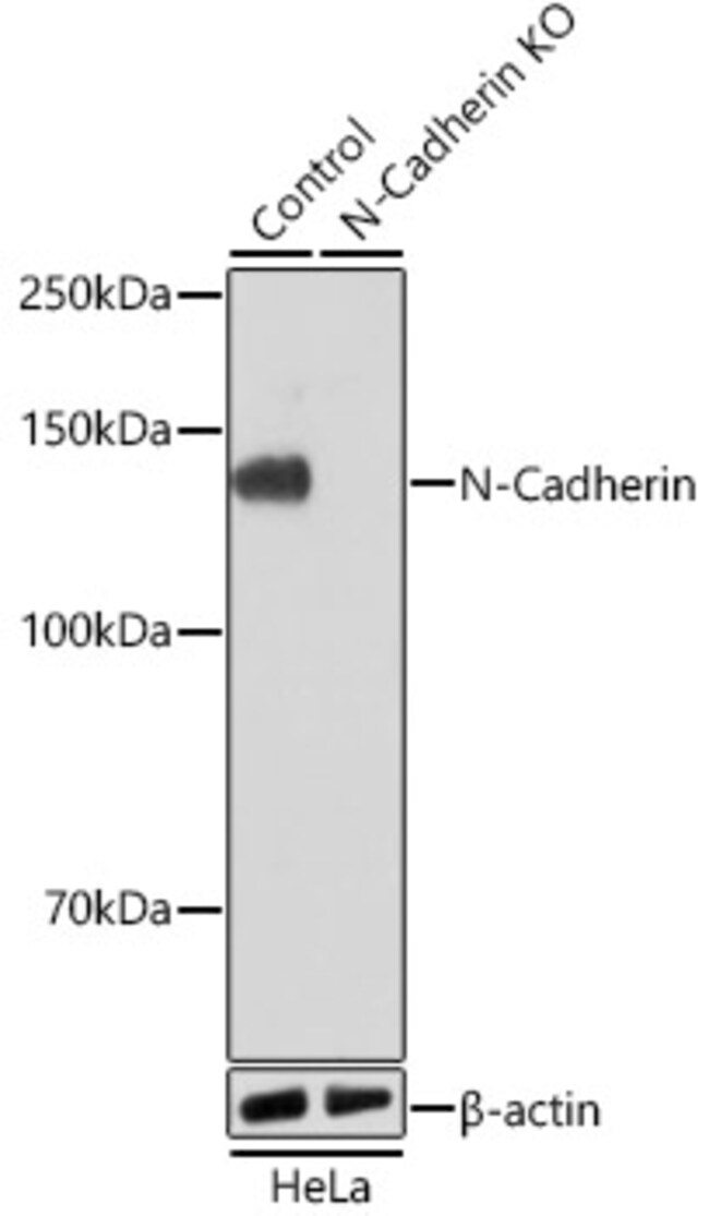 ABclonal Technology [KO Validated] N-Cadherin Rabbit mAb 100 L ...